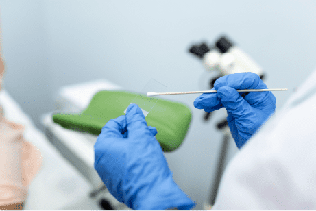 Beneficios de la Citología en Base Líquida - Fundación InnovaGen